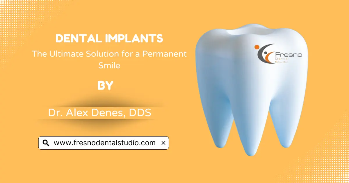 Dental Implants: The Ultimate Solution for a Permanent Smile - Fresno ...